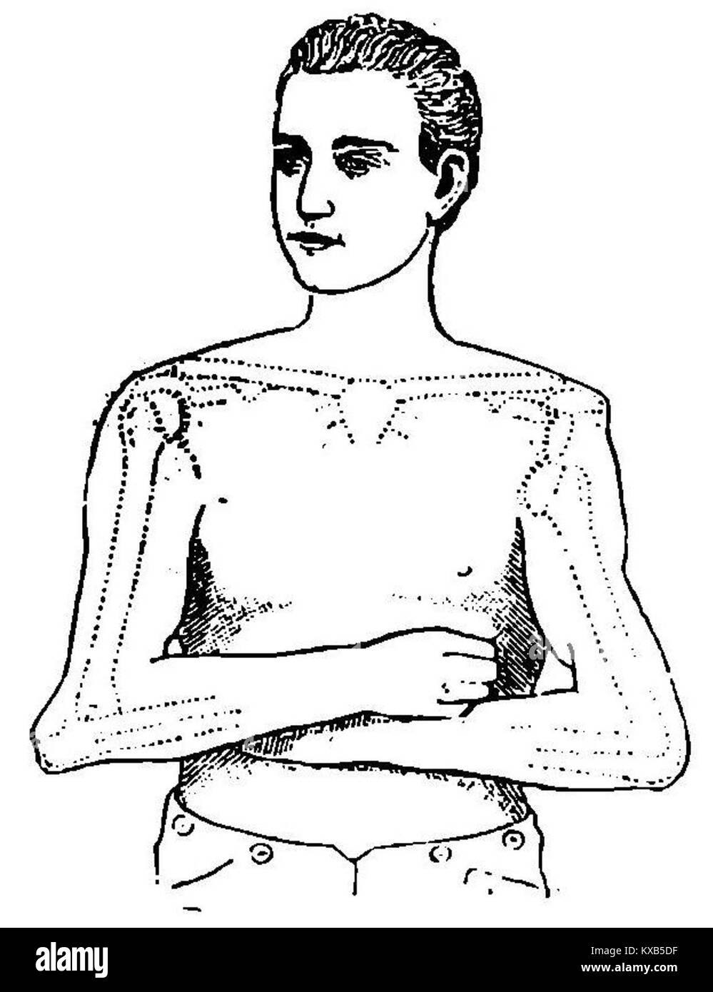 Joints movement Black and White Stock Photos & Images - Alamy