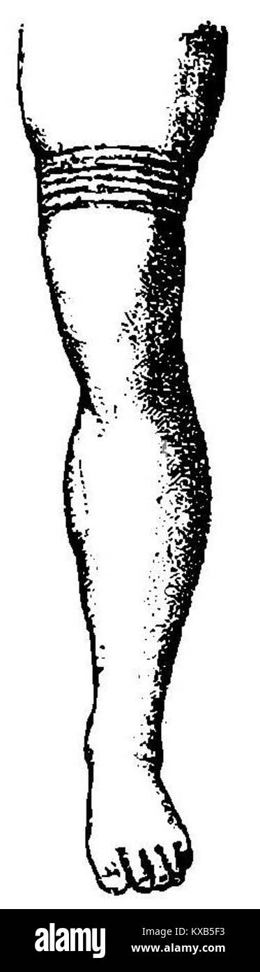 A scientific paper on the mechanical compression of the femur ...