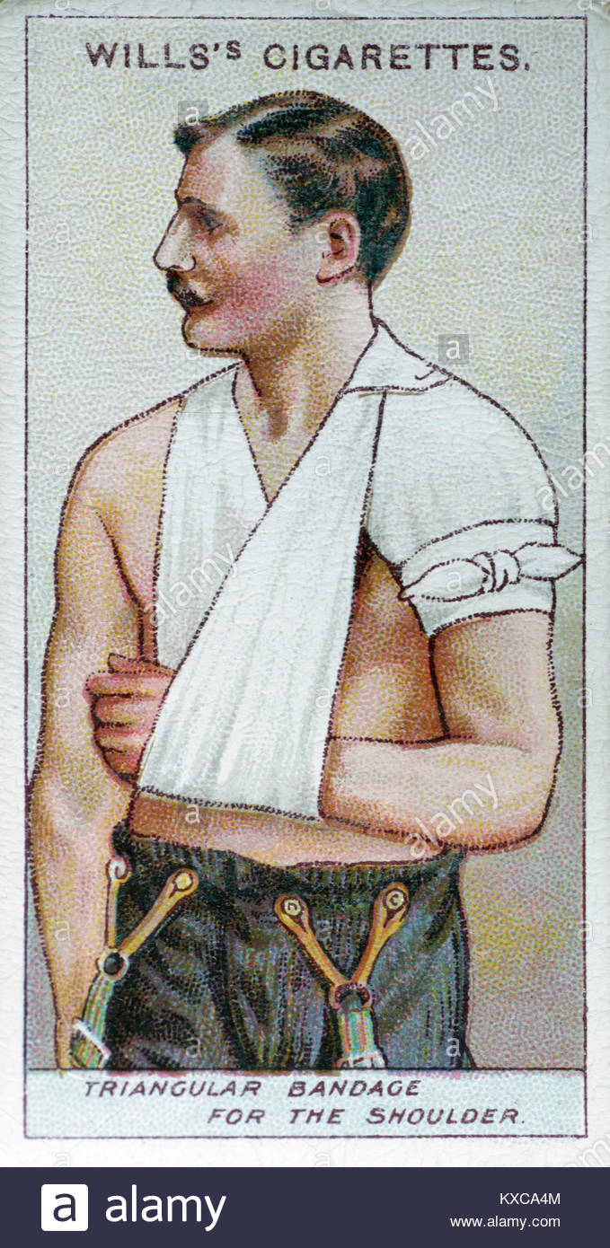 Triangular Bandages (sling)