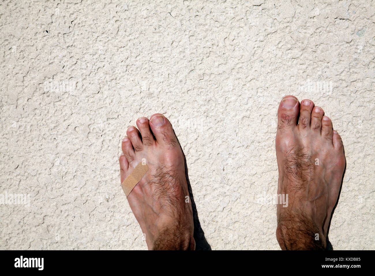 Pair of feet with Plaster Stock Photo - Alamy