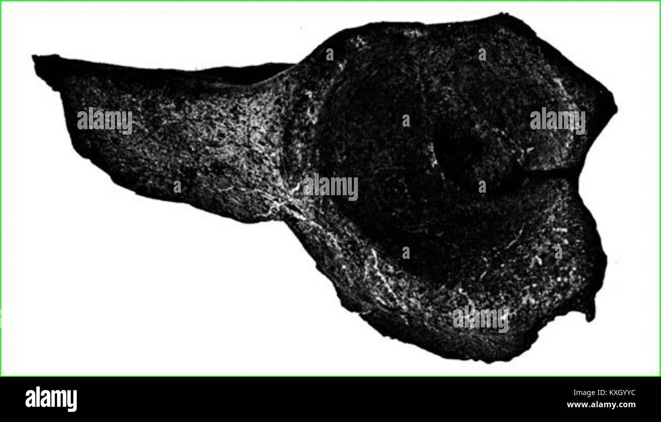 Joint anatomy hi-res stock photography and images - Alamy