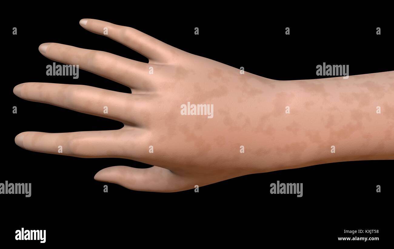 Aging Hand, skin , age spots lighter spots surface color. 3d rendering ...