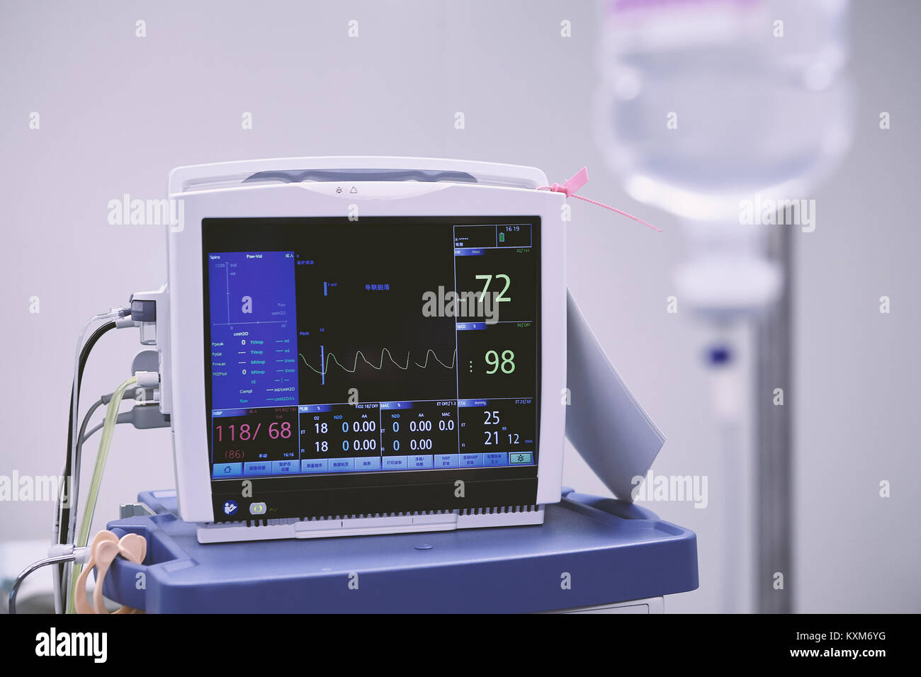 Vital signs medical monitor in maternity ward operating theatre Stock ...