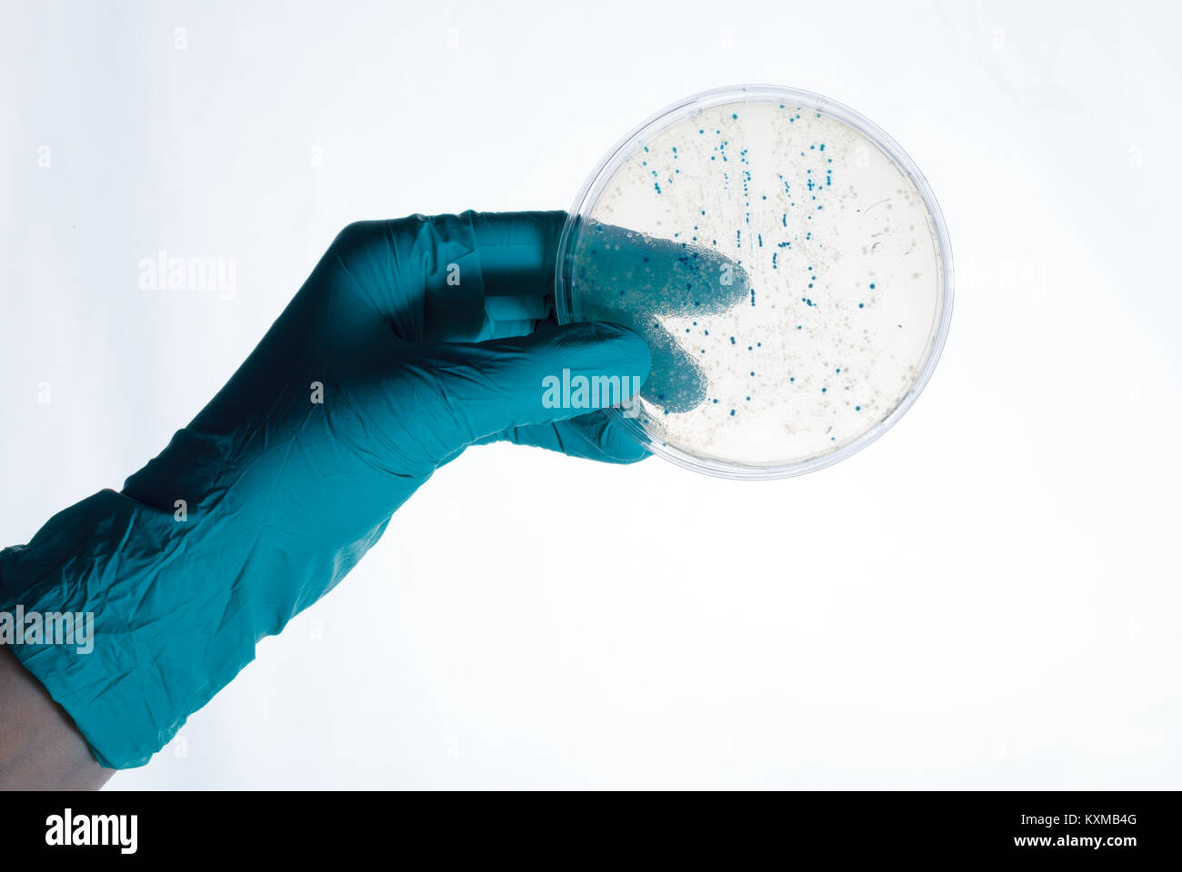 colonies in petri dish for cloning of transgenic vector into plasmid ...