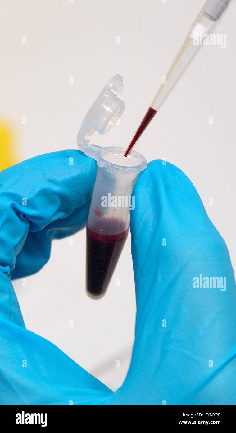 Forensic tests hi-res stock photography and images - Alamy