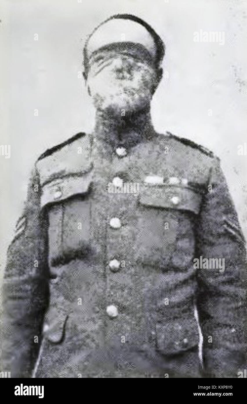A British soldier during World War I wearing a veil respirator, a key ...