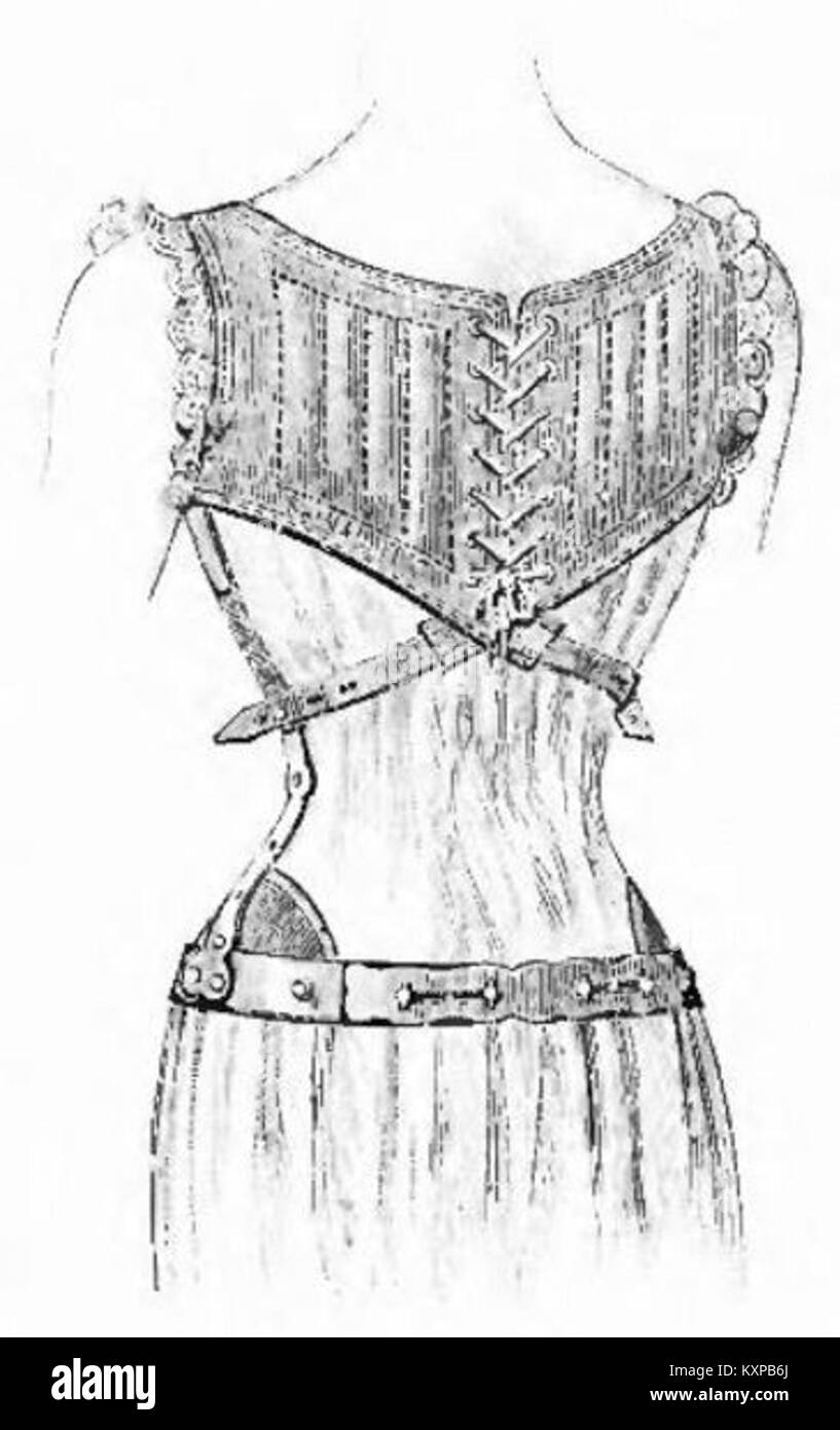Figure 1922 from the Rainal Frères corset catalogue illustrates another ...