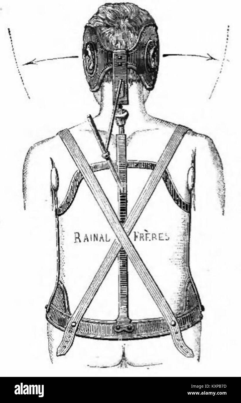 Catalogue de corsets de Rainal Frères Fig 475 Stock Photo - Alamy