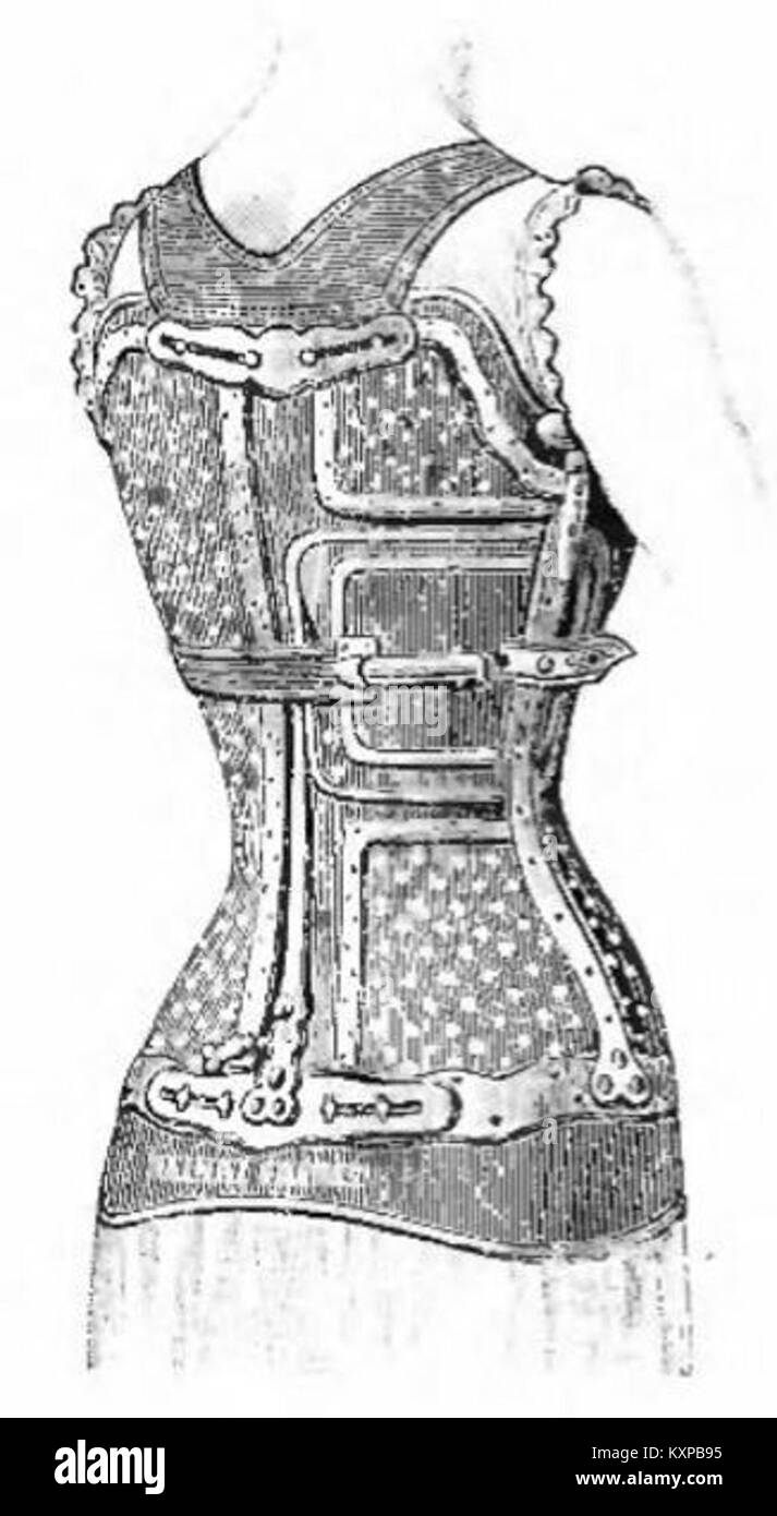 The Rainal Frères catalogue includes Figure 1441, illustrating a ...