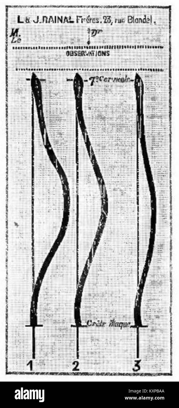 This catalogue from Rainal Frères, figure 1989, presents corset designs ...