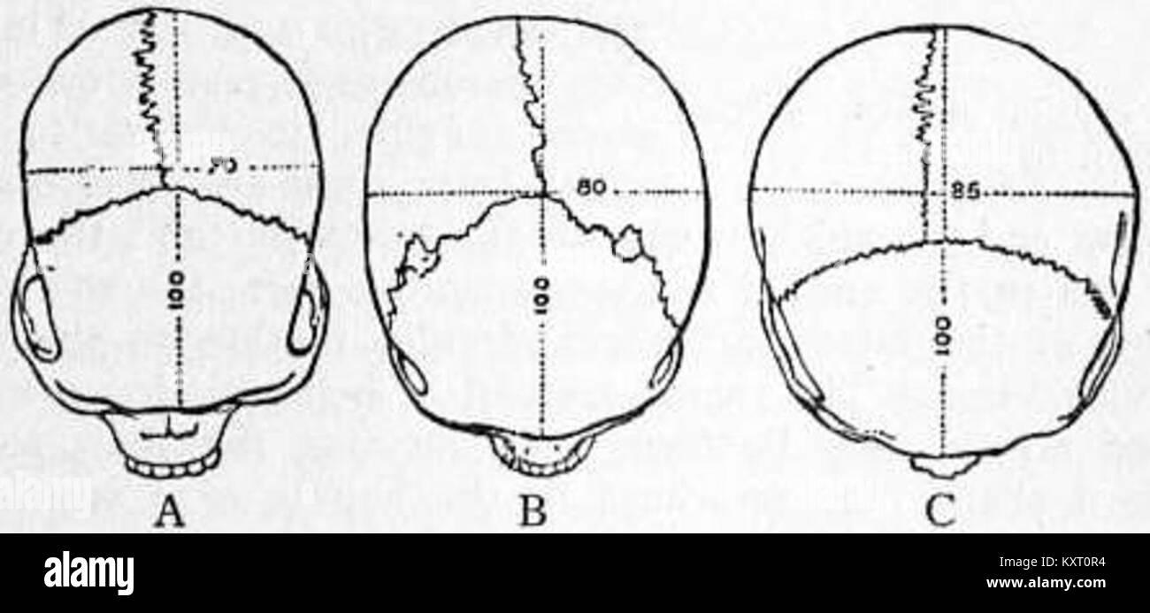 EB1911 Craniometry - Fig. 4.—Top view of skulls Stock Photo - Alamy