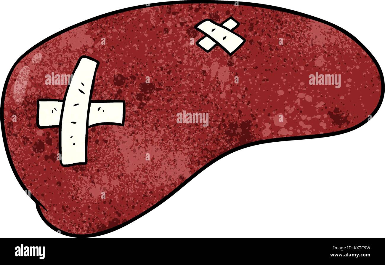 cartoon repaired liver Stock Vector Image & Art - Alamy