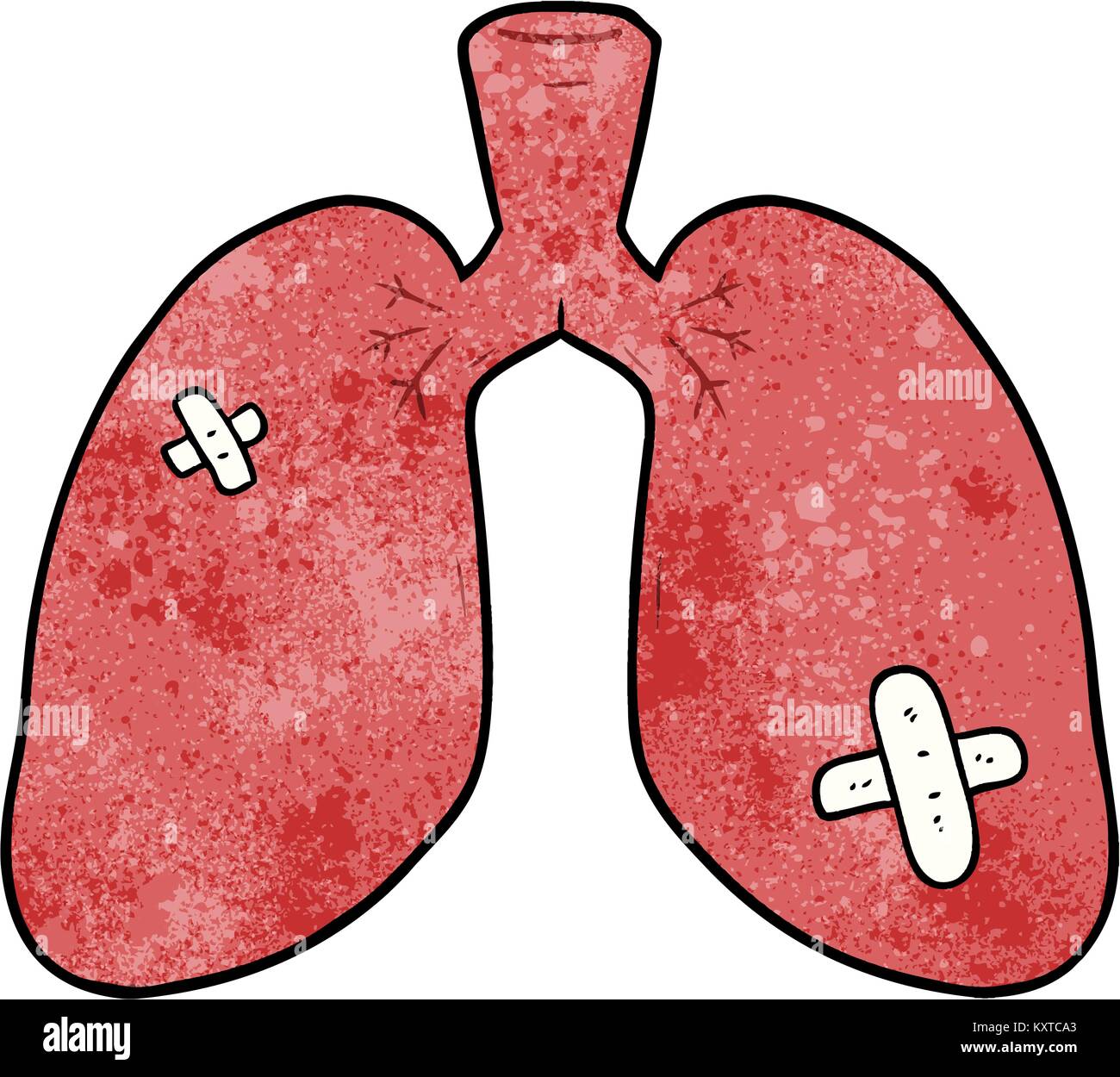 cartoon repaired lungs Stock Vector Image & Art - Alamy