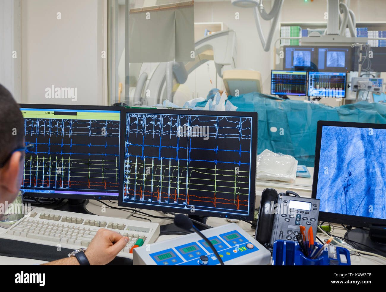 Monitors with heartbeat rate and x-ray image in modern hospital ...