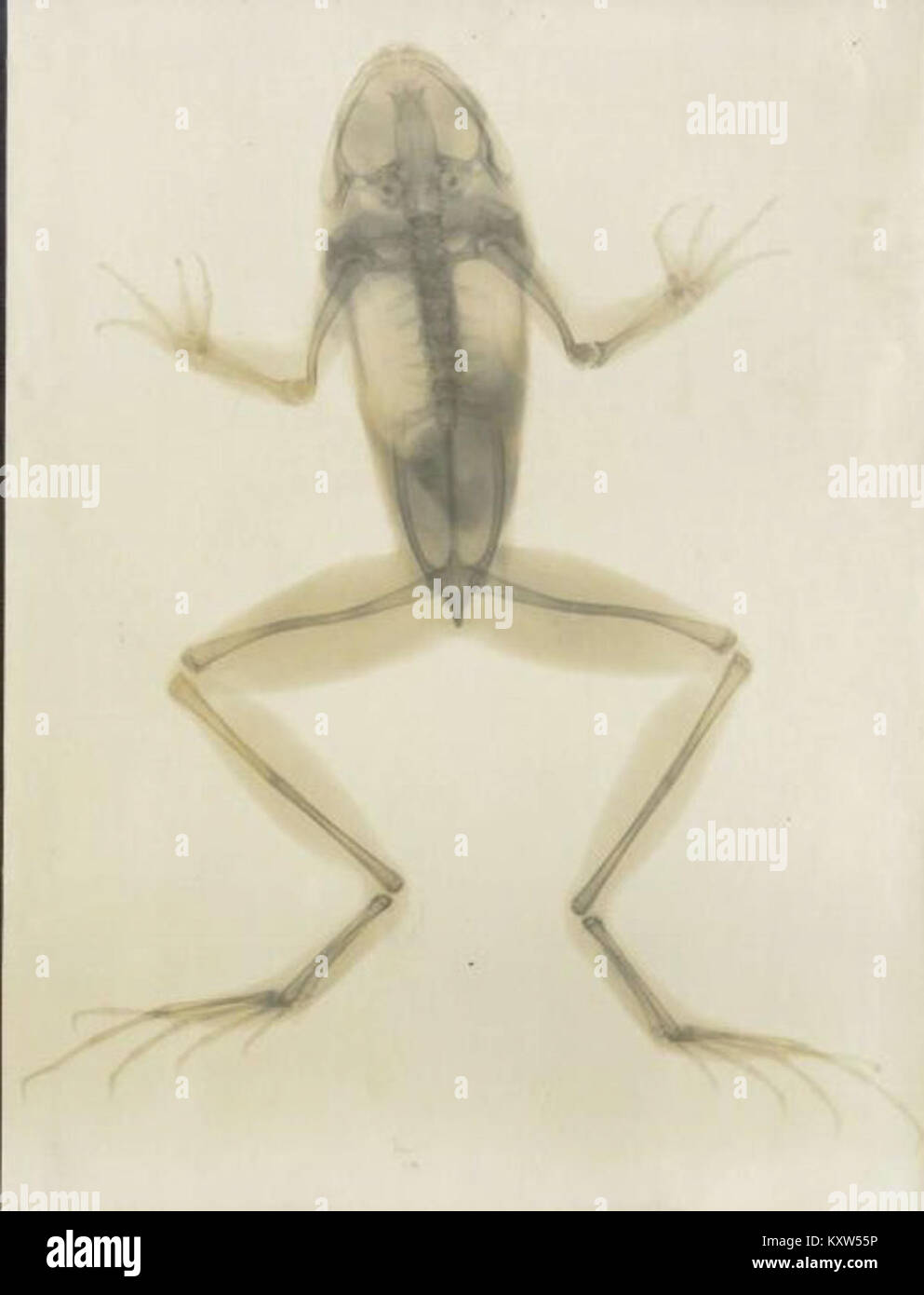 Early x ray images hi-res stock photography and images - Alamy