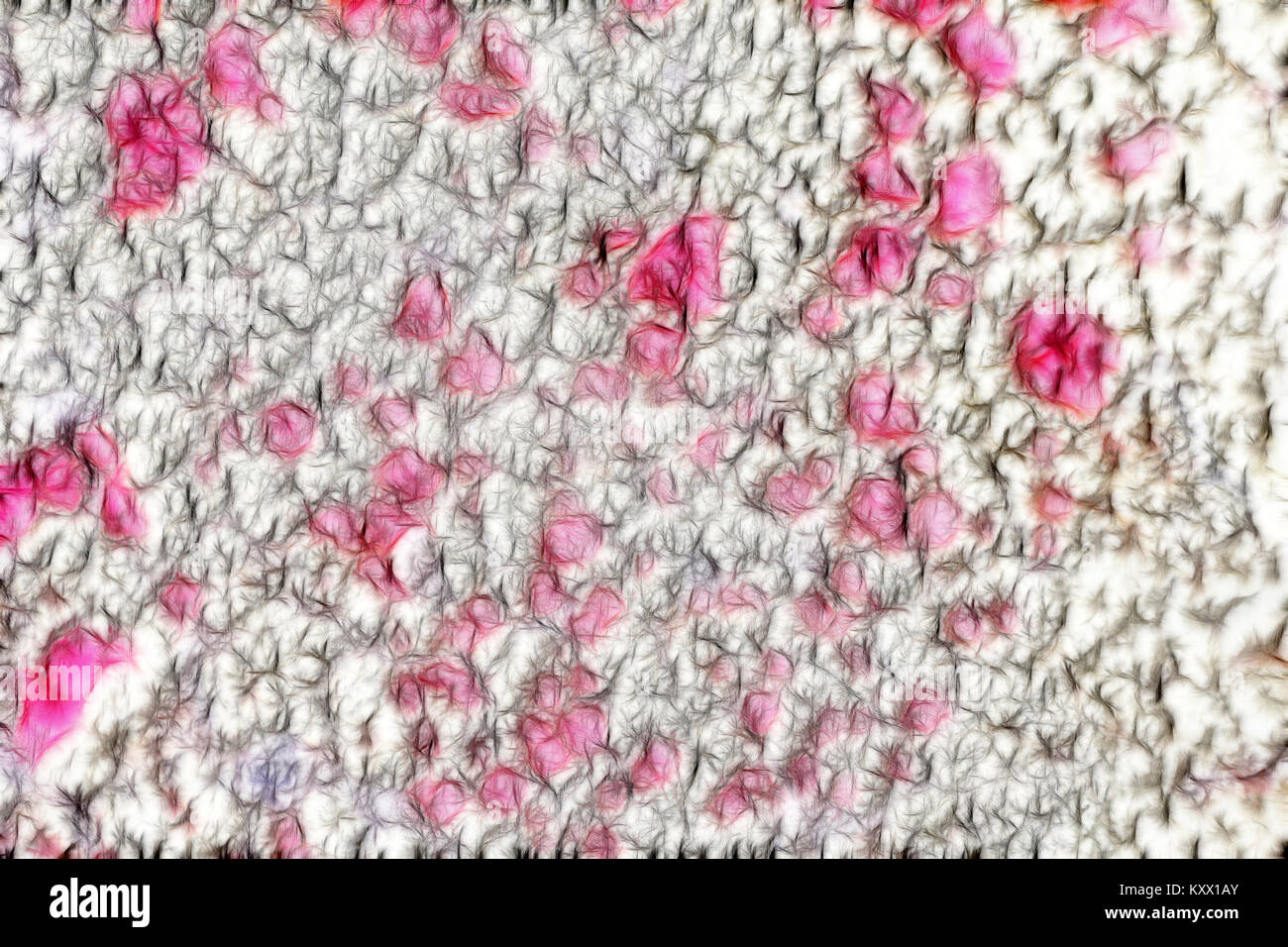 Pimply hi-res stock photography and images - Alamy