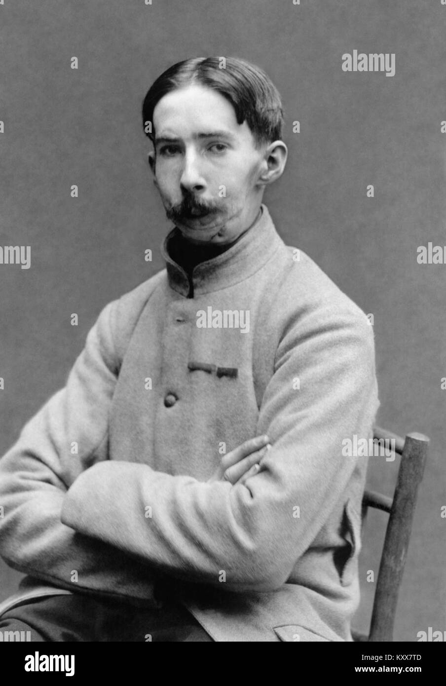 French mutilé without mask2 Stock Photo - Alamy