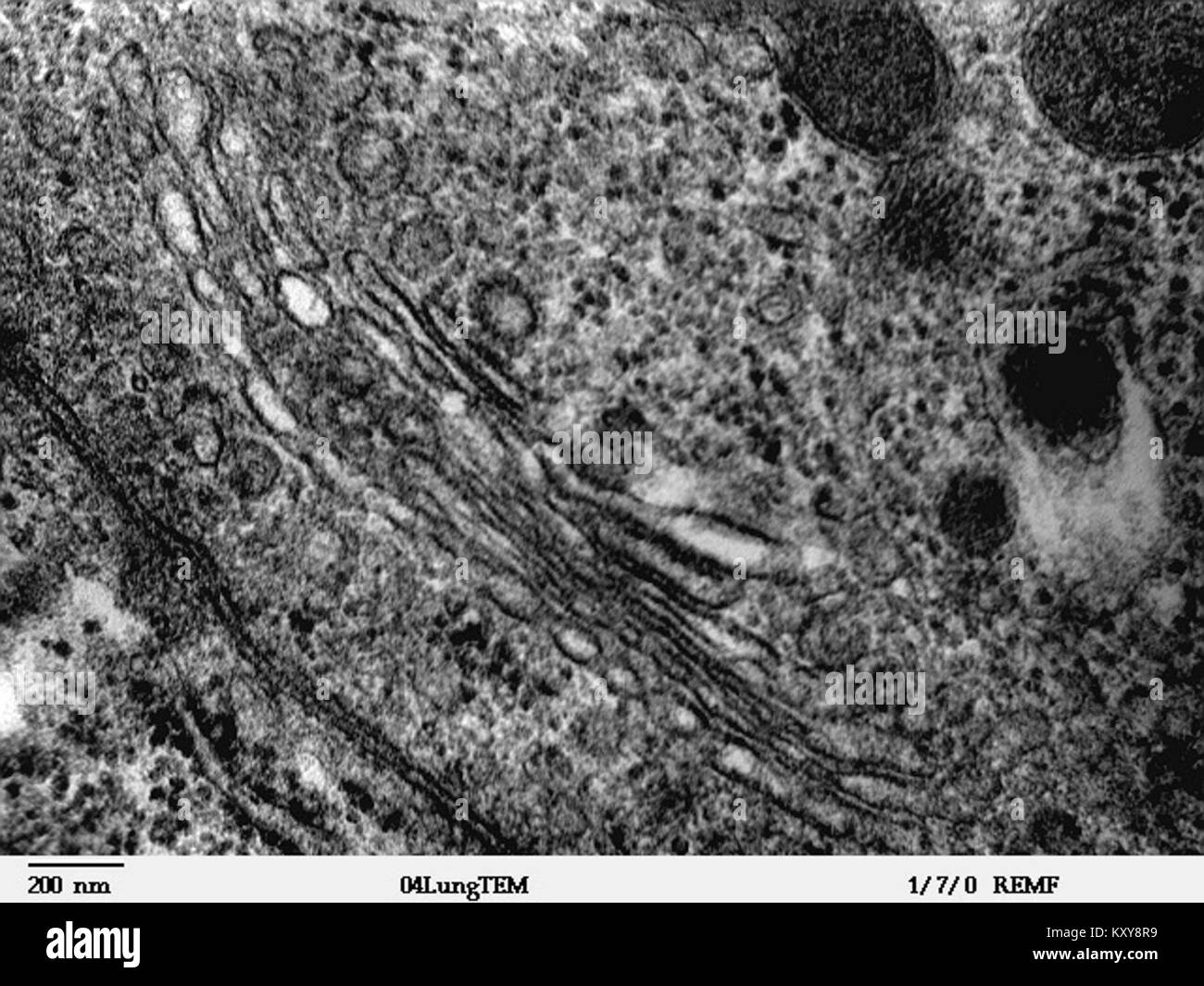 Golgi in the cytoplasm of a macrophage in the alveolus (lung) - TEM ...