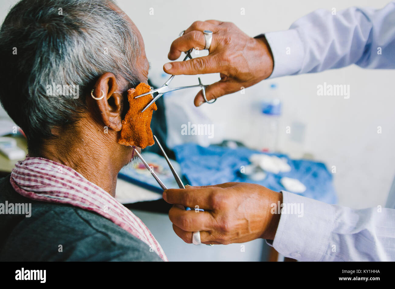 Nepalese man affected by leprosy has his face ulcer treated Stock Photo ...