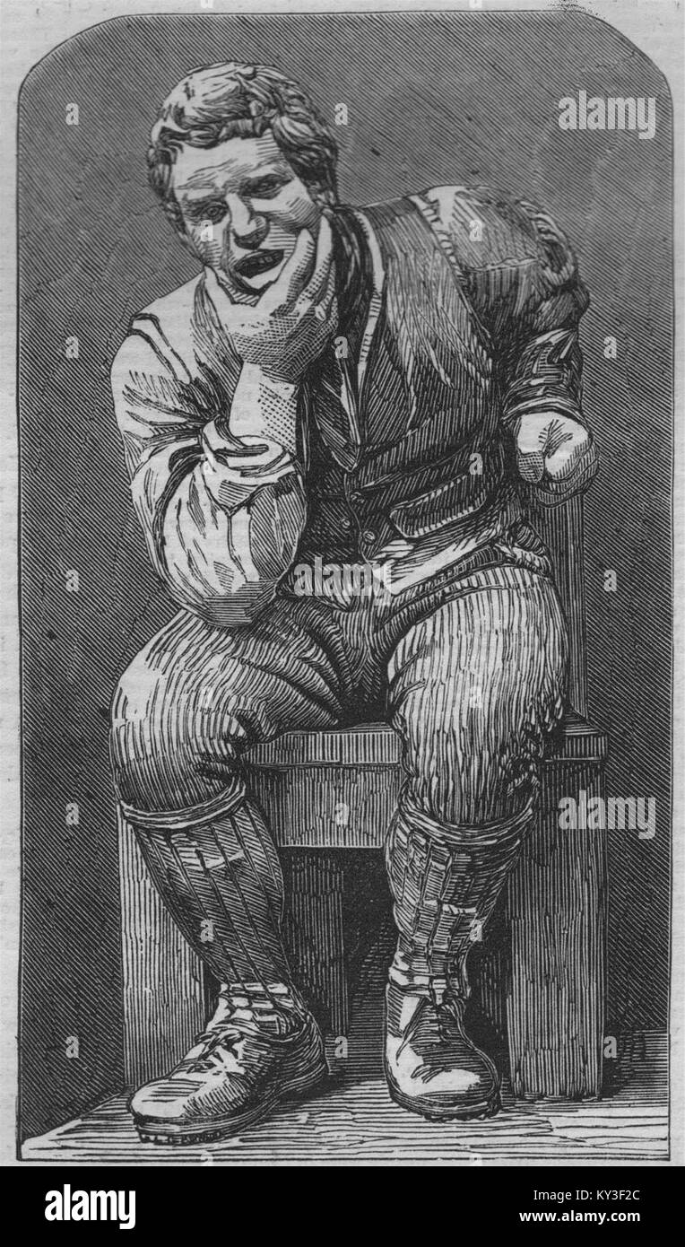 The Burns Centenary. "Toothache". Scotland 1859. The Illustrated London ...