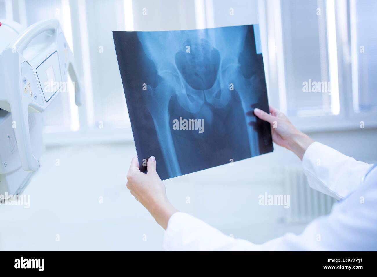 Doctor holding x-ray of a human pelvis Stock Photo - Alamy