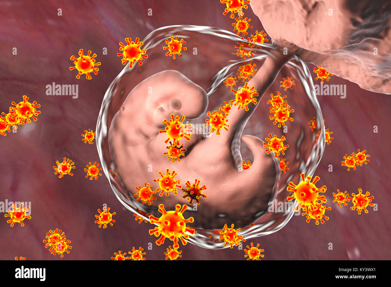 Viruses infecting human embryo, conceptual illustration. The embryo is ...