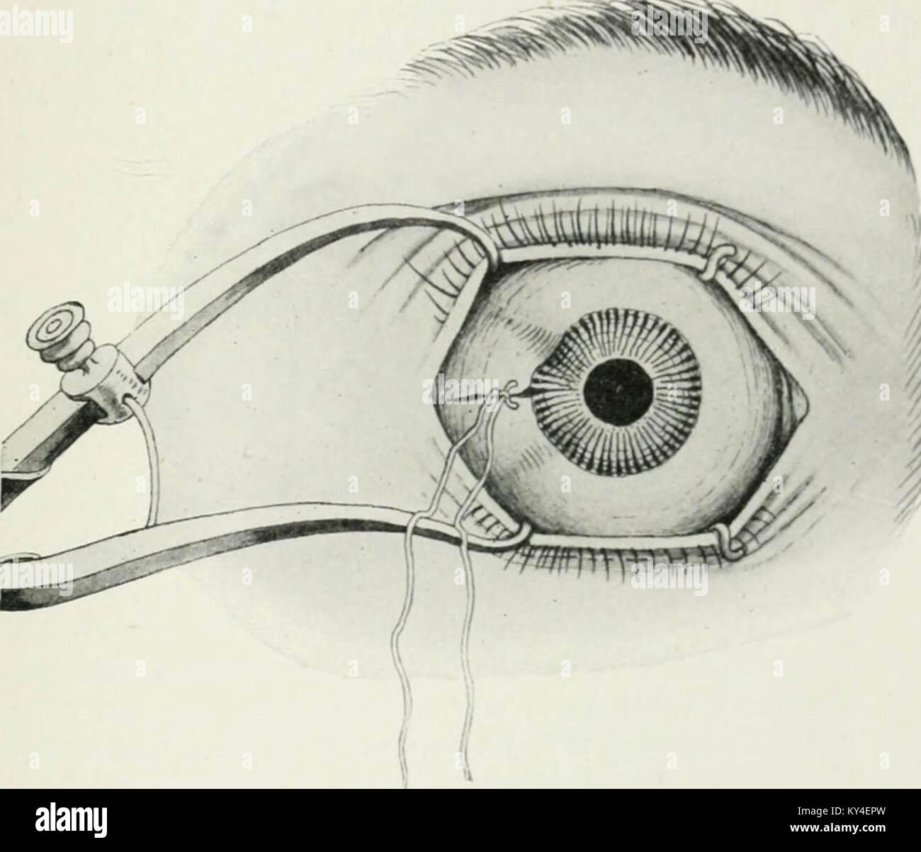 Ophthalmology ancient hi-res stock photography and images - Alamy