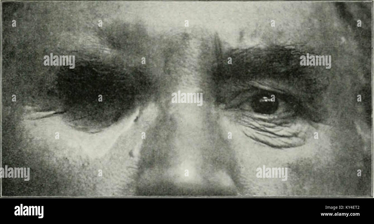 Ophthalmology ancient hi-res stock photography and images - Alamy