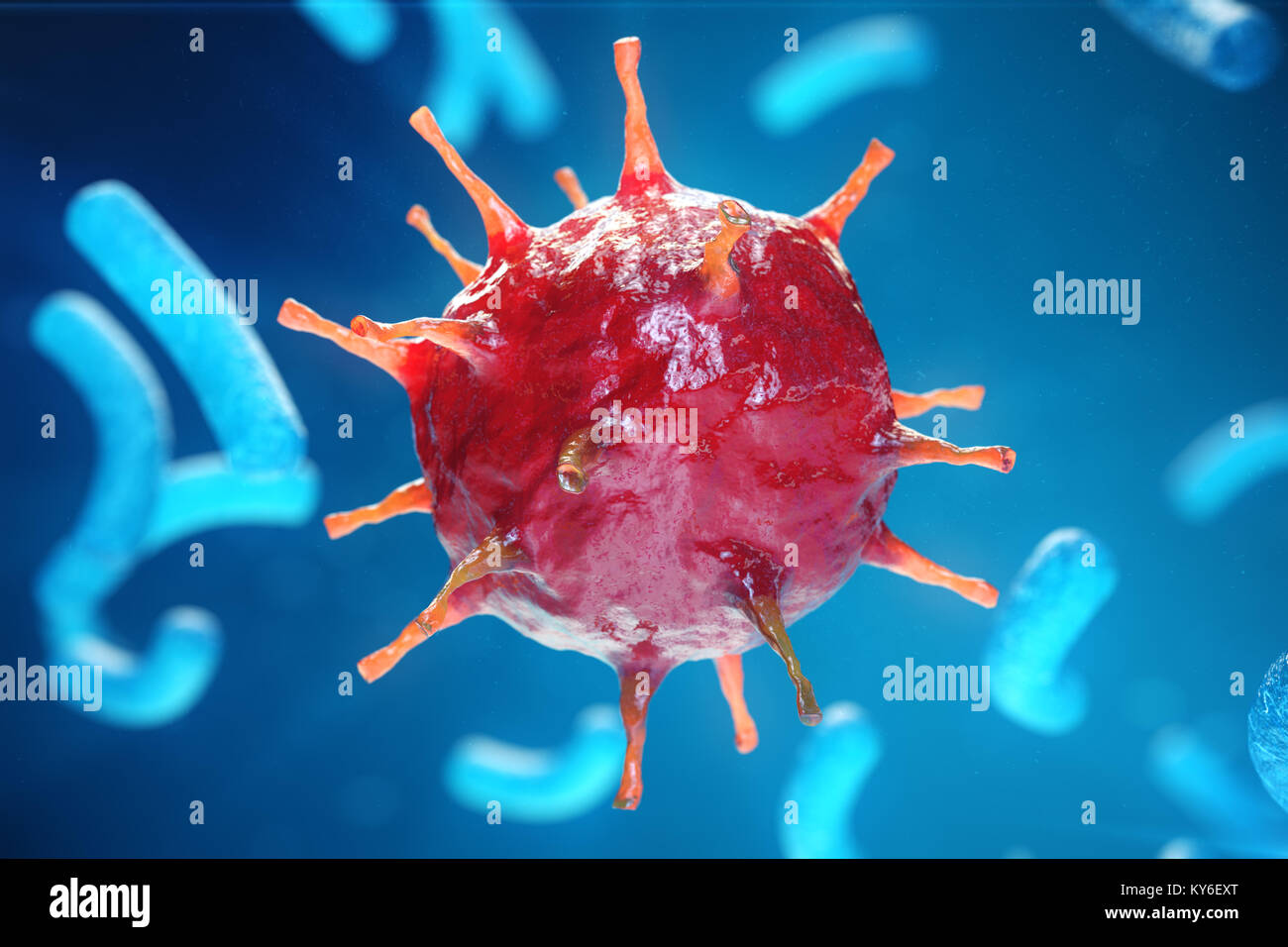 Viral hepatitis infection causing chronic liver disease, Hepatitis ...