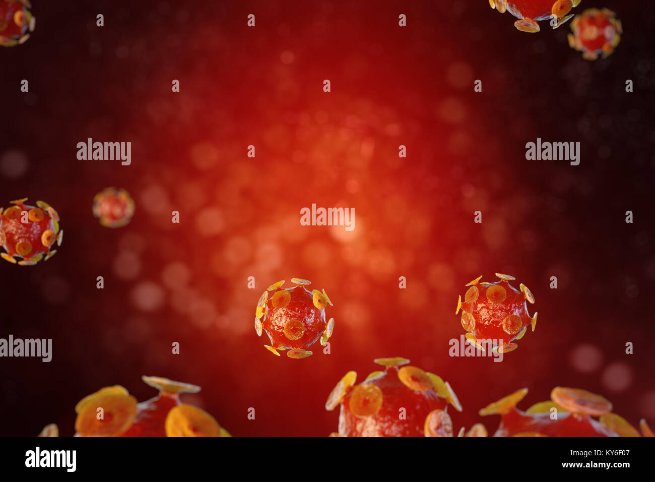 Viral hepatitis infection causing chronic liver disease , Hepatitis ...