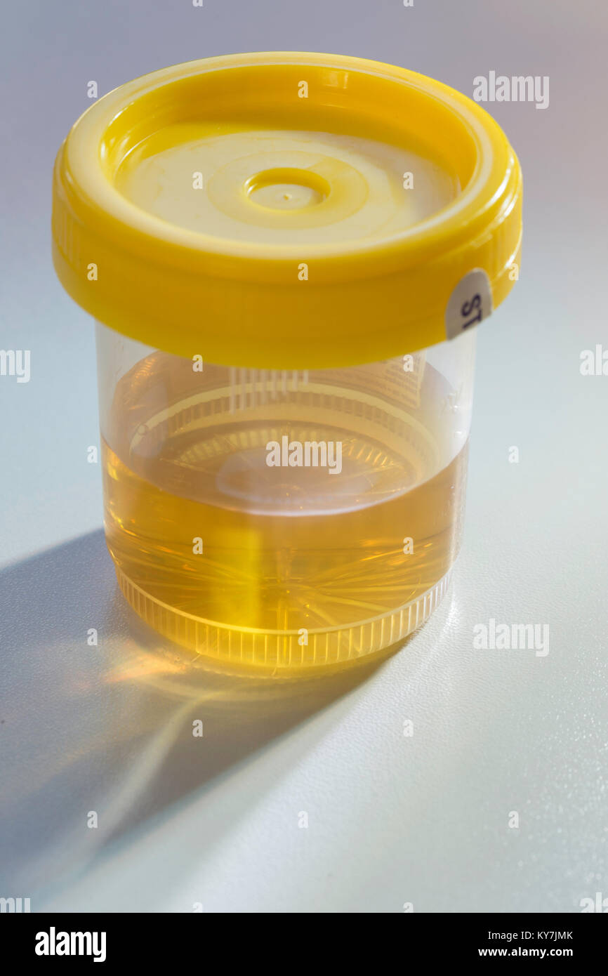 Sterile plastic urine sample container, USA Stock Photo - Alamy