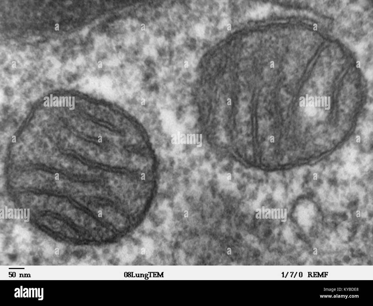 This transmission electron microscope (TEM) image shows mitochondria ...
