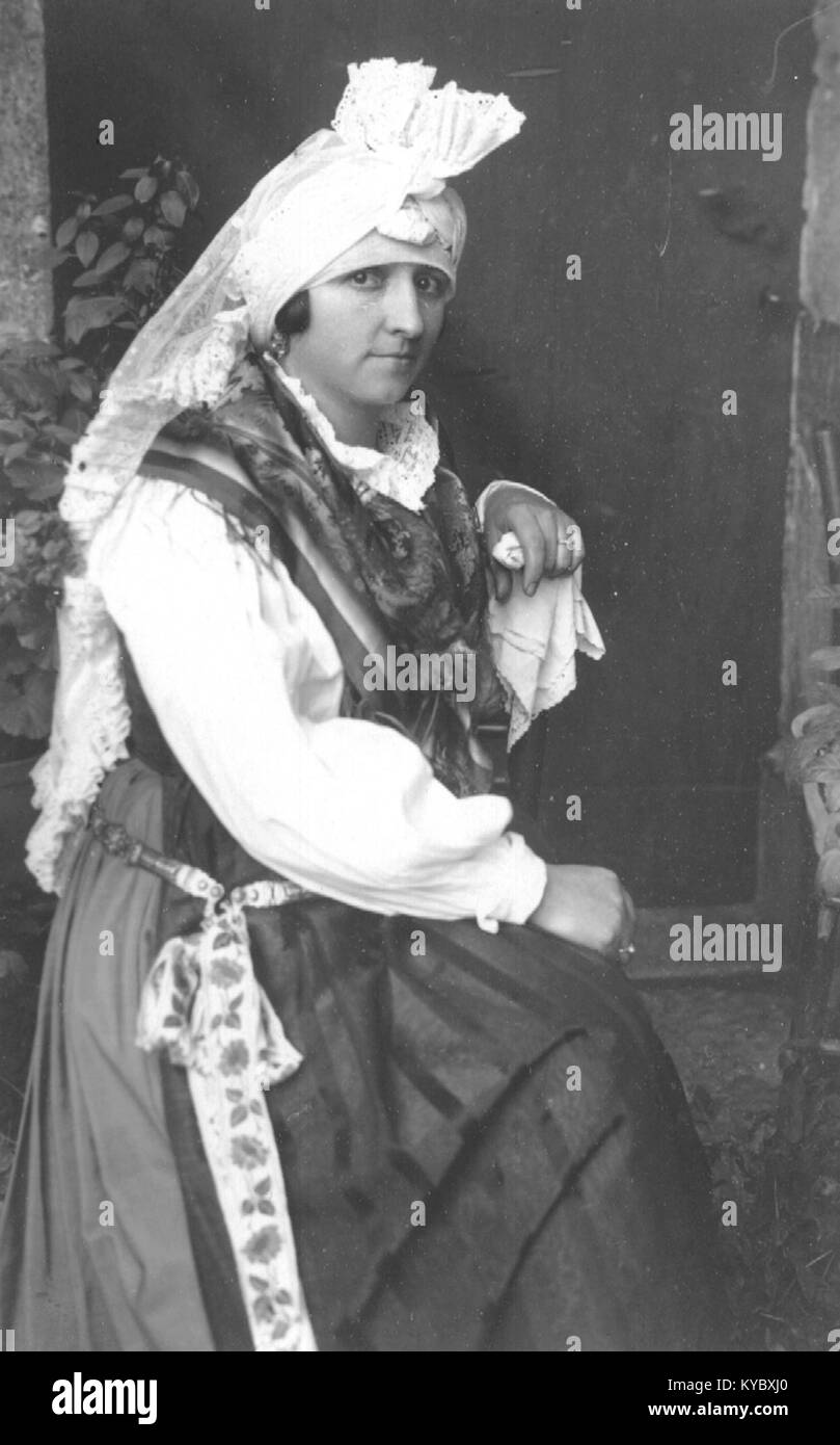 A reconstruction of a 19th-century nose prosthetic design, illustrating ...