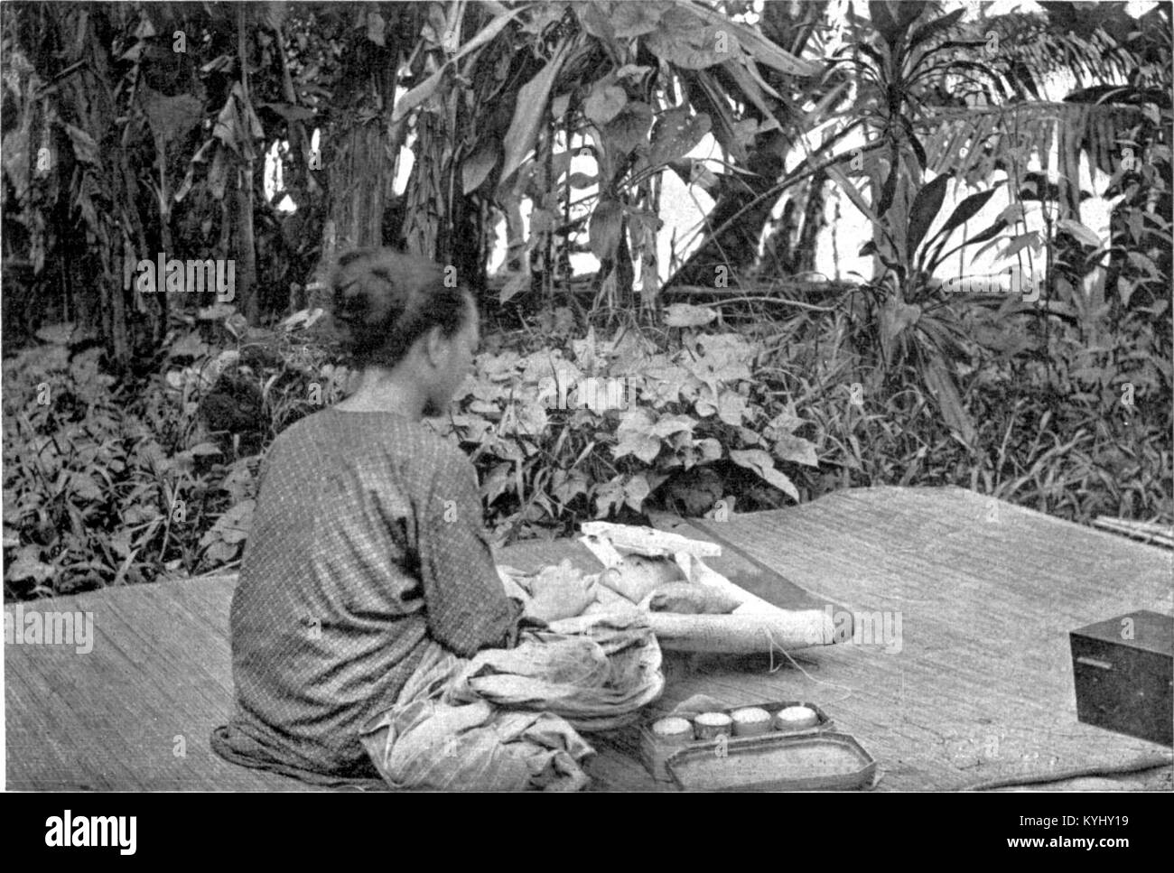 This image shows the skull deformation of a young child from Milan ...