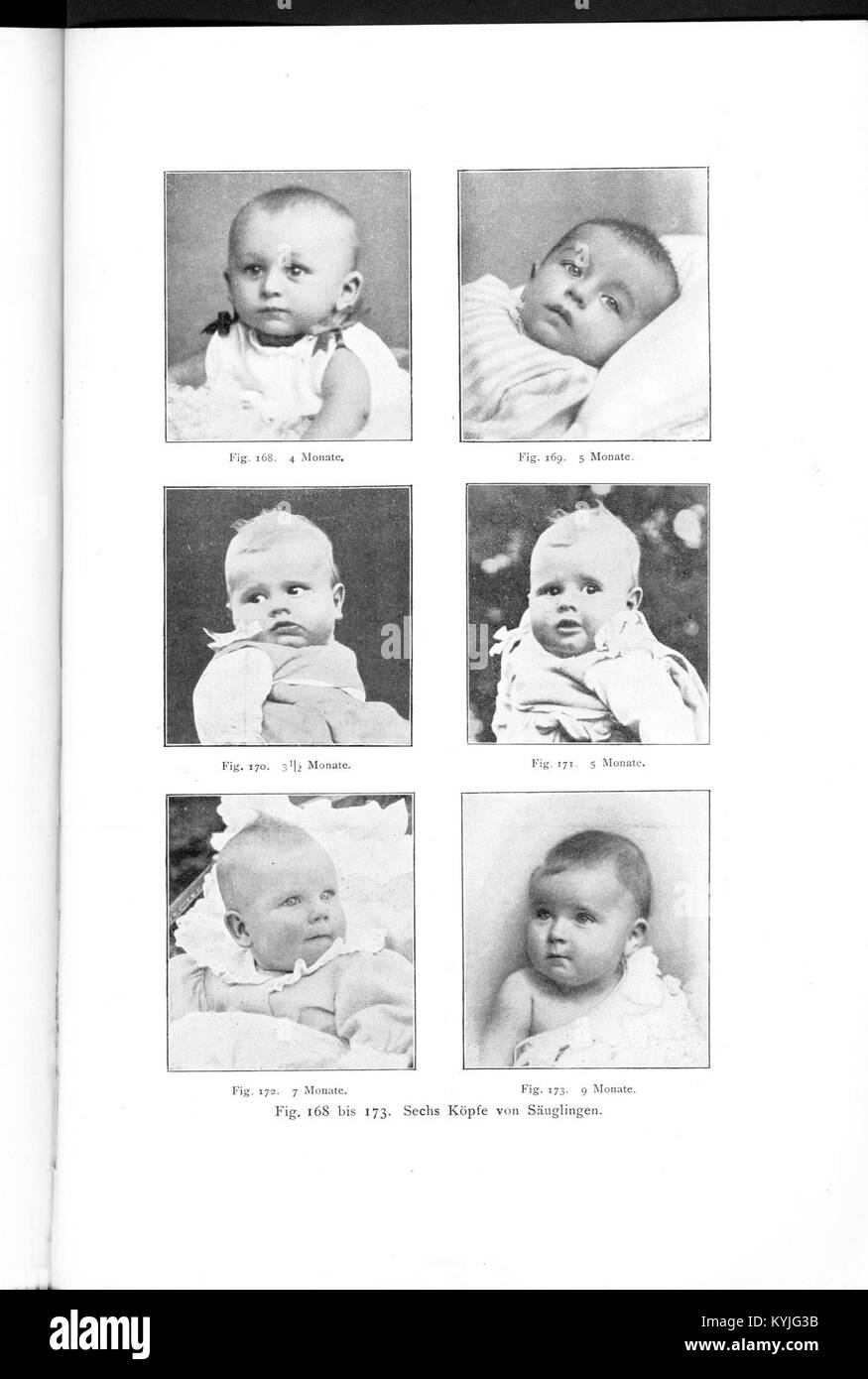 An illustration from 'Körper des Kindes' by Stratz, depicting the human ...