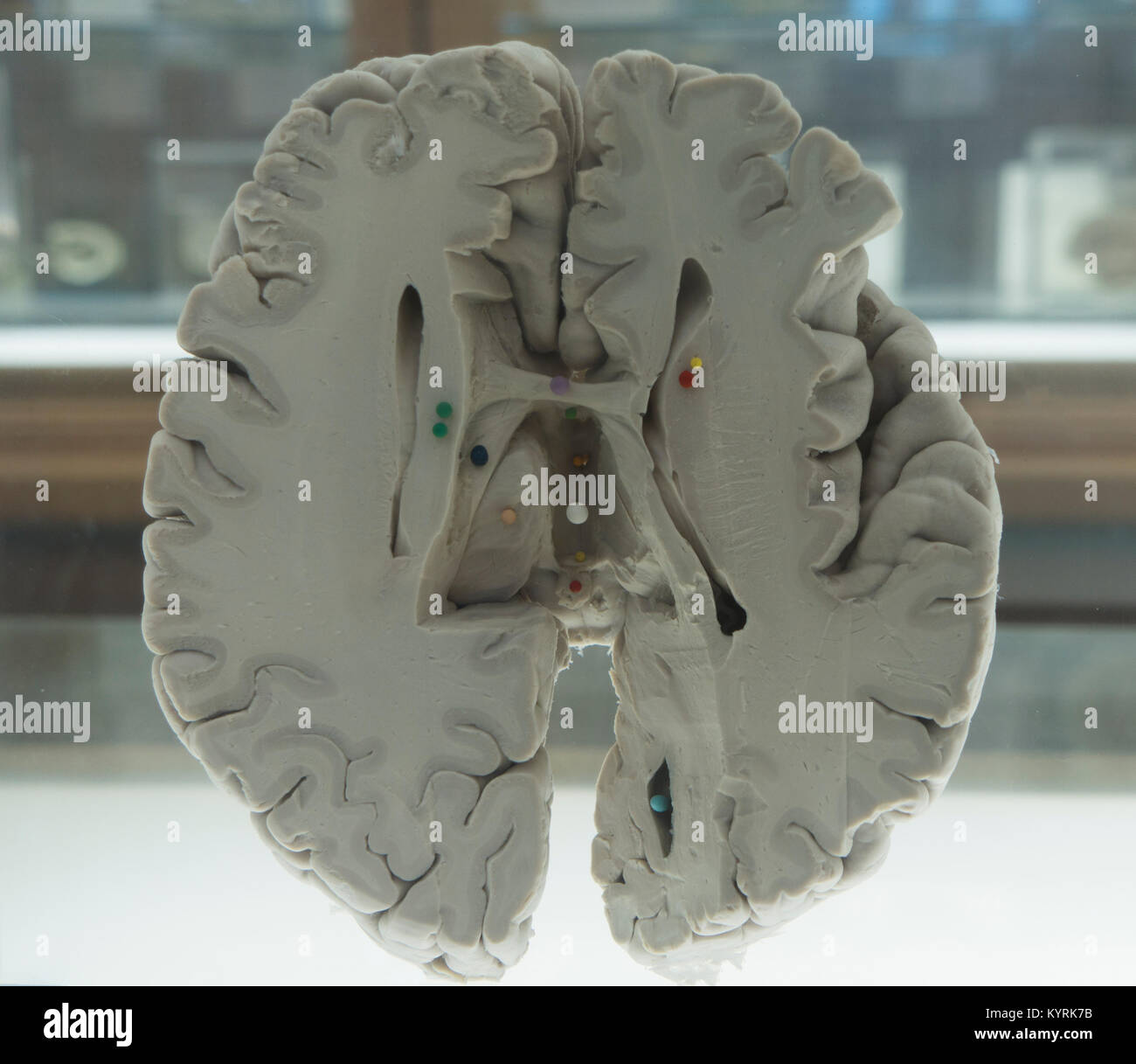 Brain museum university at Buffalo NY Stock Photo - Alamy