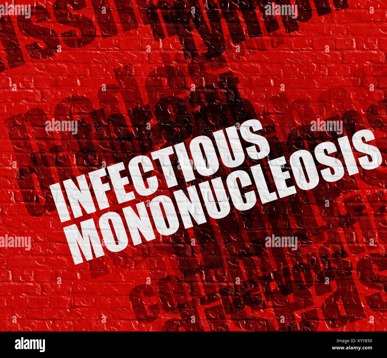 Infectious mononucleosis hi-res stock photography and images - Alamy