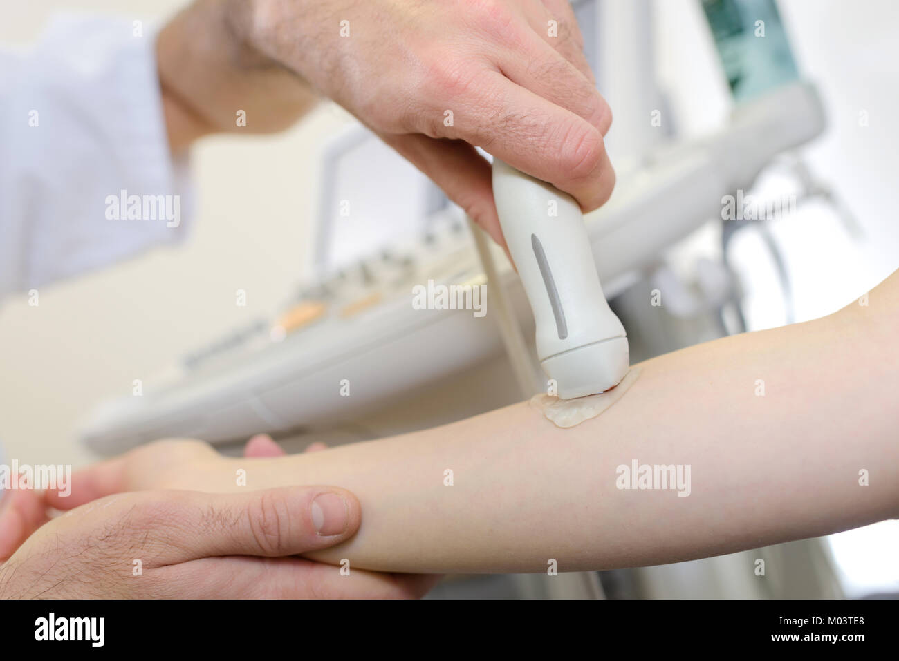 Doctor doing ultrasound of patient's arm Stock Photo - Alamy