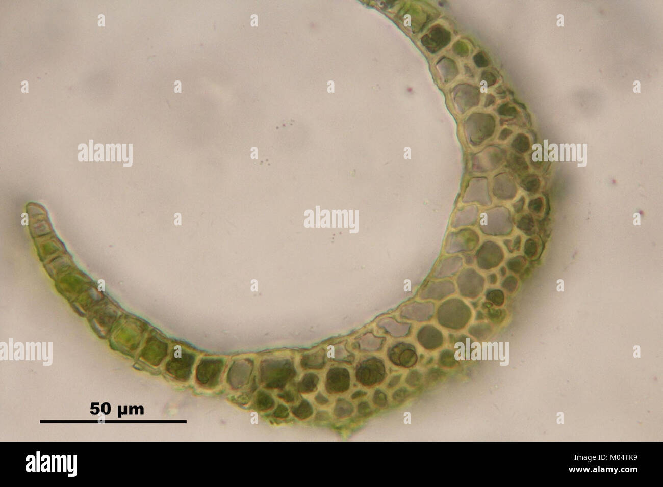 Microscopic image of Campylopus pyriformis, a species of moss. The ...