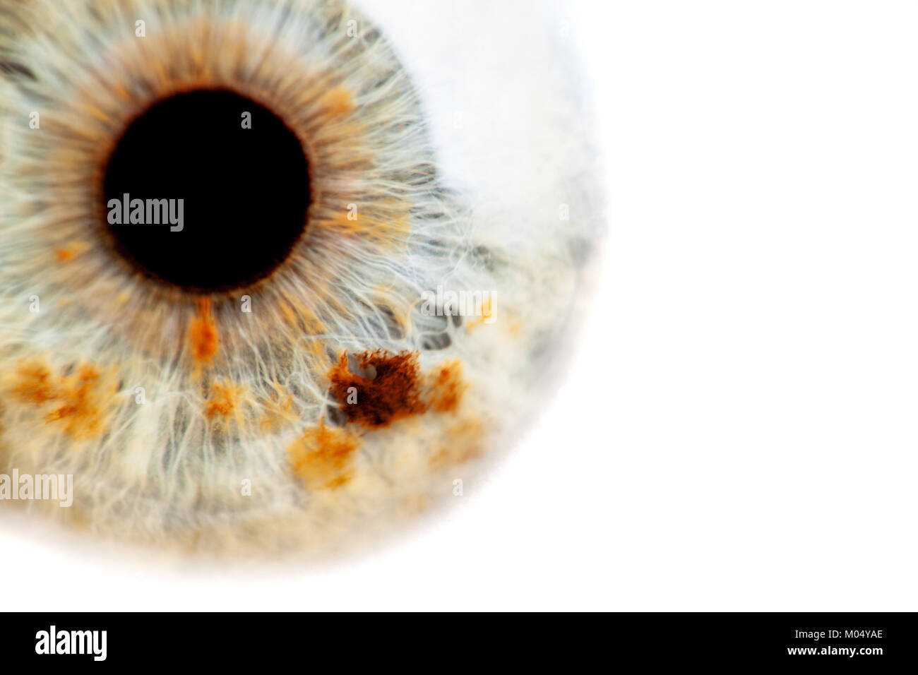 extreme close up of a human eye with reddish dots, shallow depth of ...