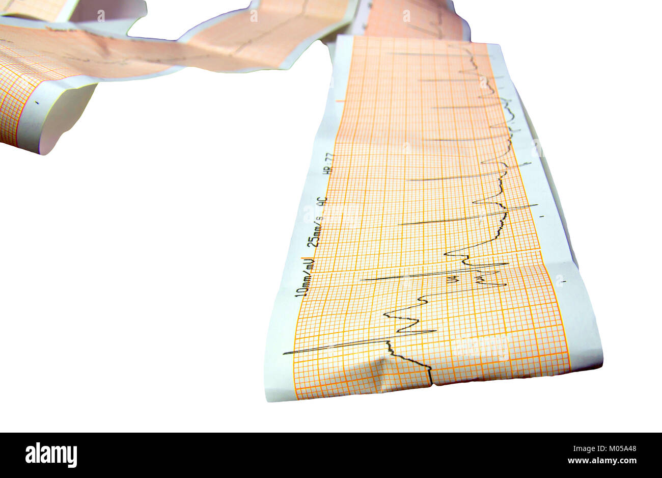 Ekg ecg hi-res stock photography and images - Alamy