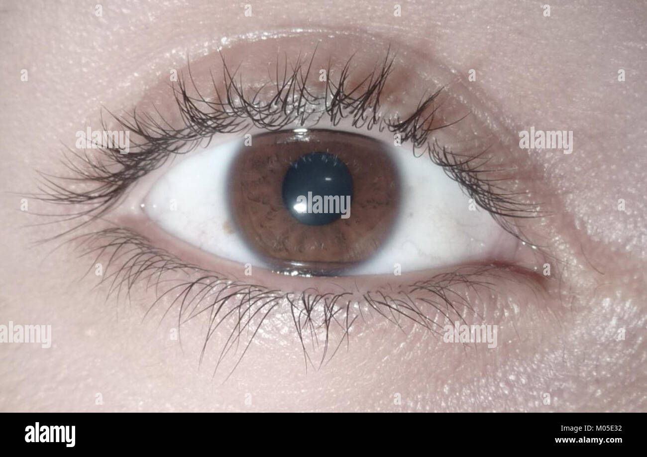 The term 'Brown eye' refers to the color and appearance of a personâ€™s ...