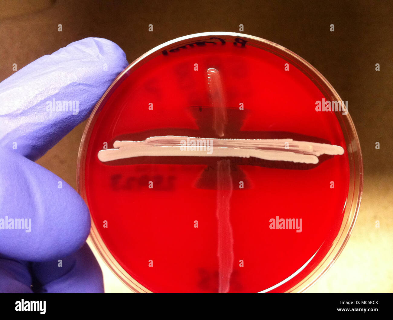 The CAMP test is a laboratory diagnostic procedure used to identify ...