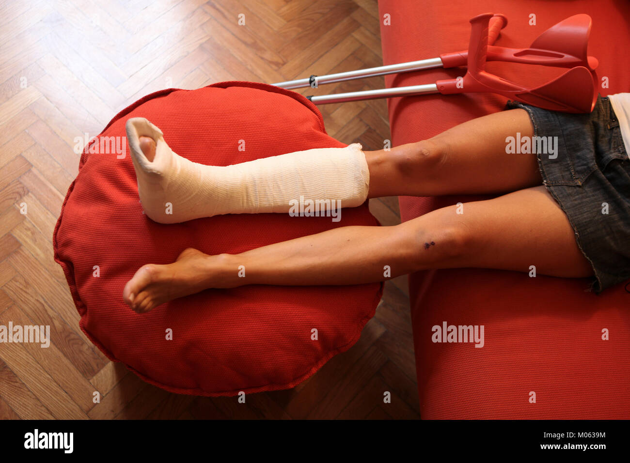 woman with one leg in plaster Stock Photo - Alamy
