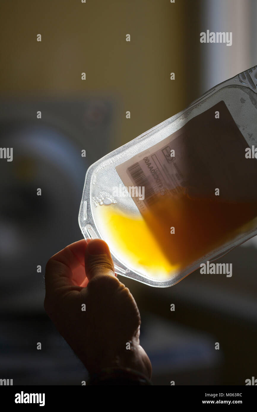 Platelet transfusion hi-res stock photography and images - Alamy