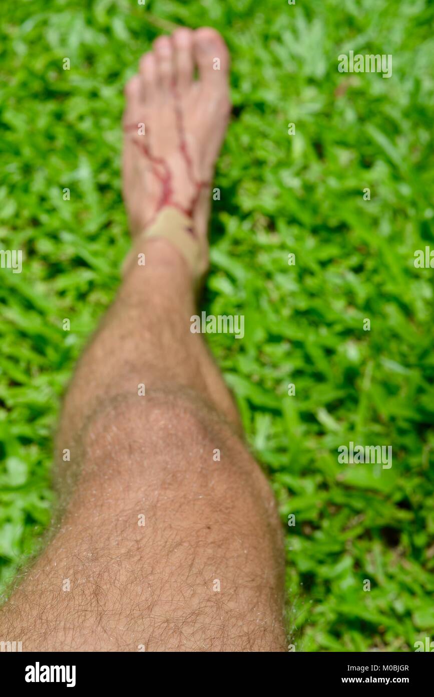 Injured male foot with real blood on a green grass background ...