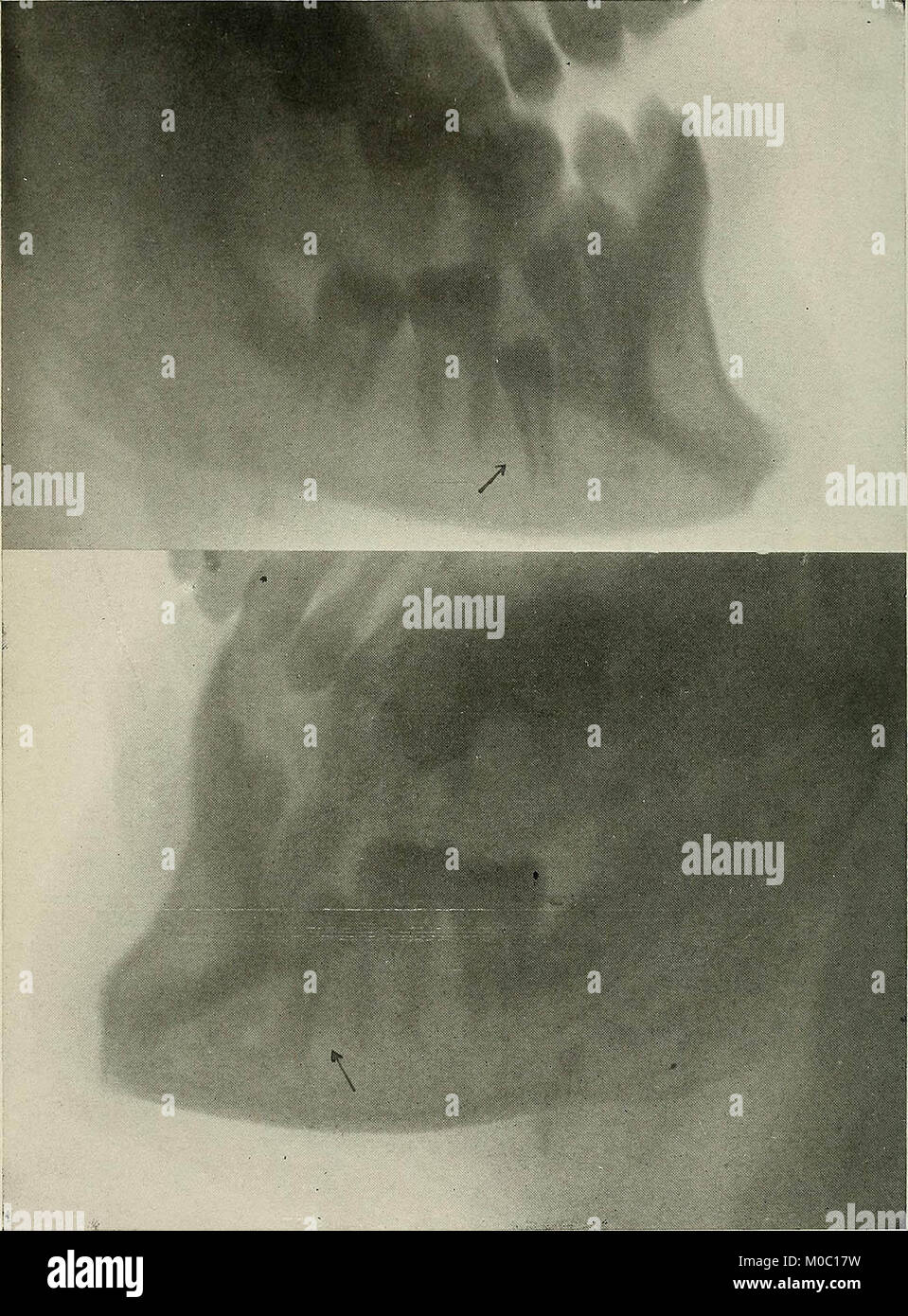 Rontgen rays and electro therapeutics hi-res stock photography and ...