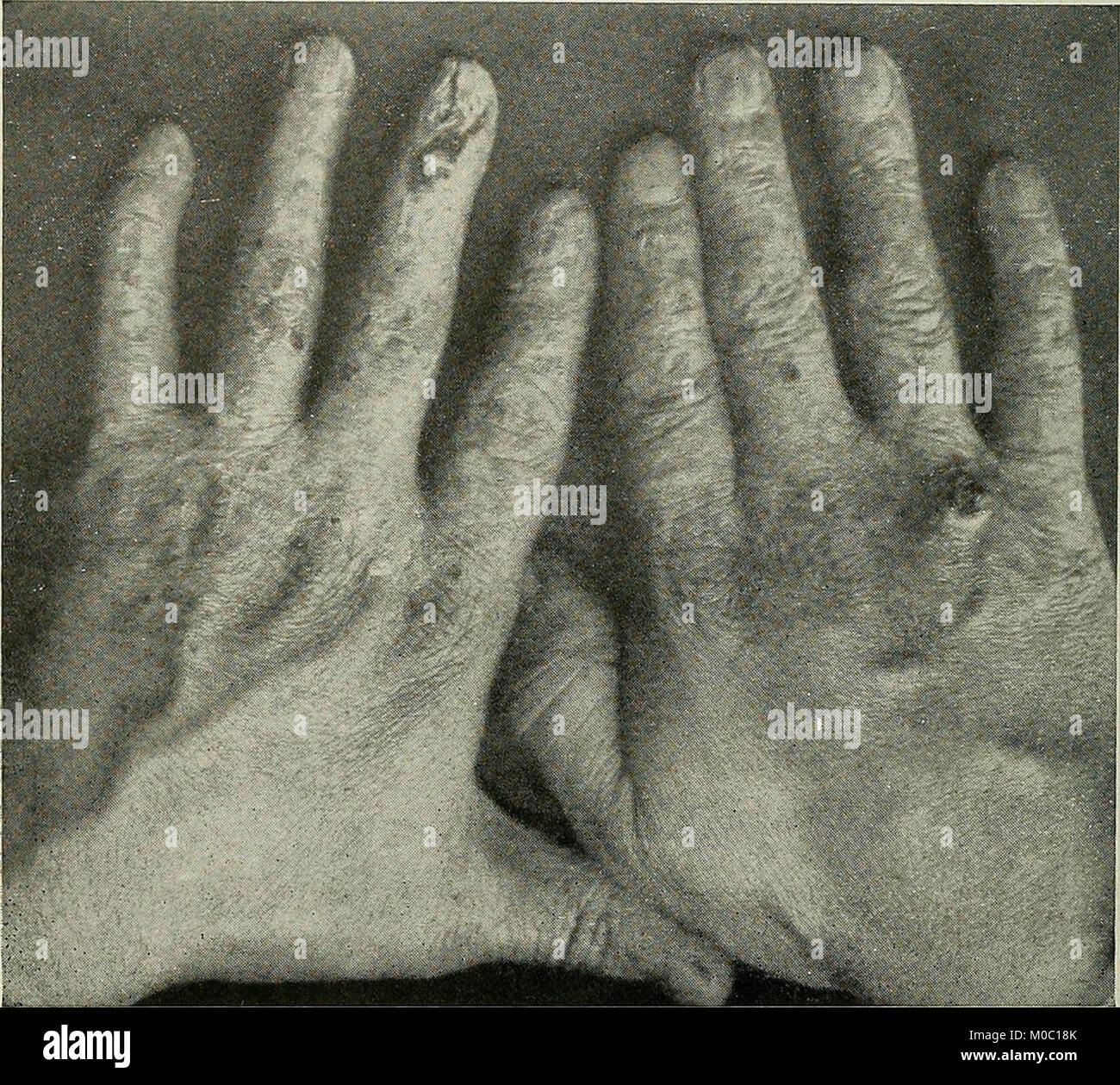 "Röntgen rays and electro-therapeutics : with chapters on radium and ...