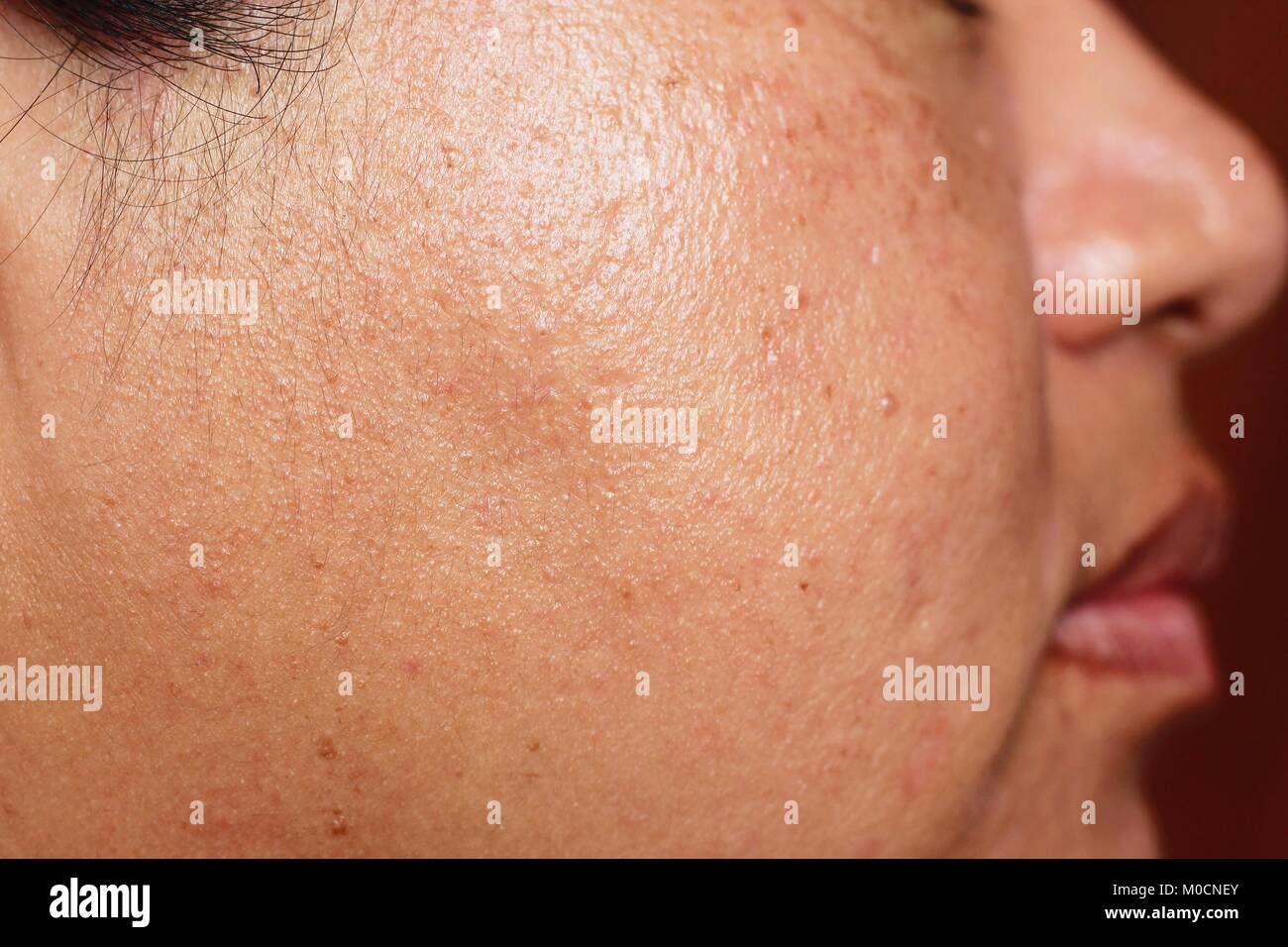 Human Skin Sweat Close Up High Resolution Stock Photography and Images ...
