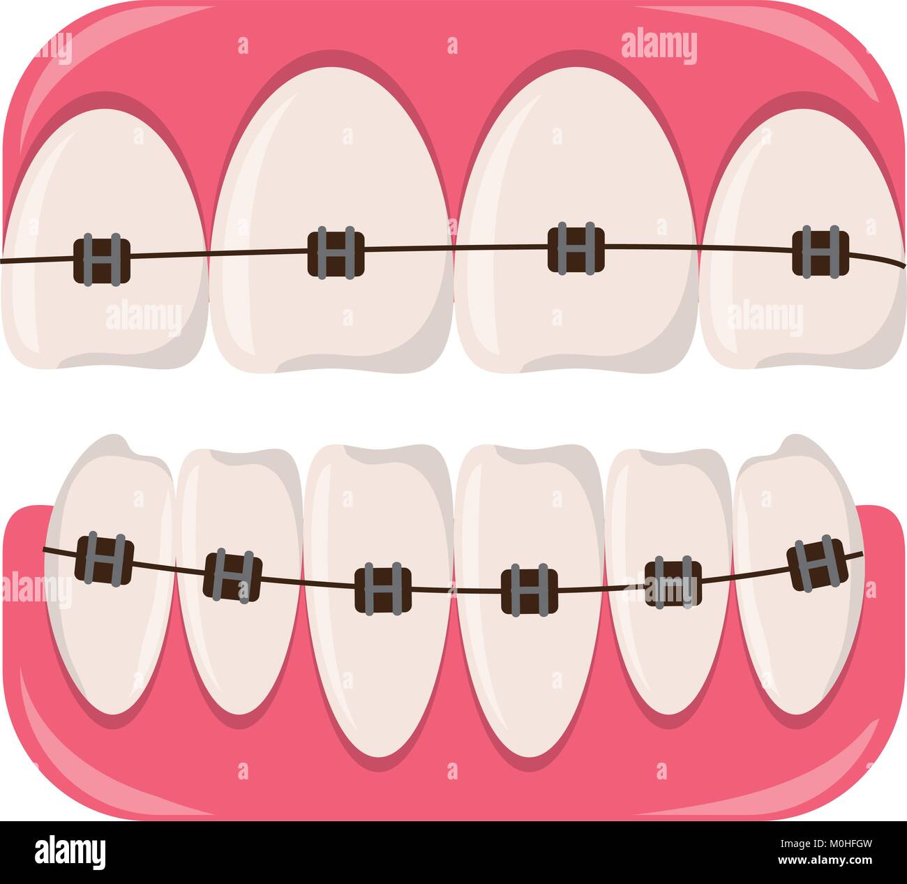 teeth with brackets icon Stock Vector Image & Art - Alamy